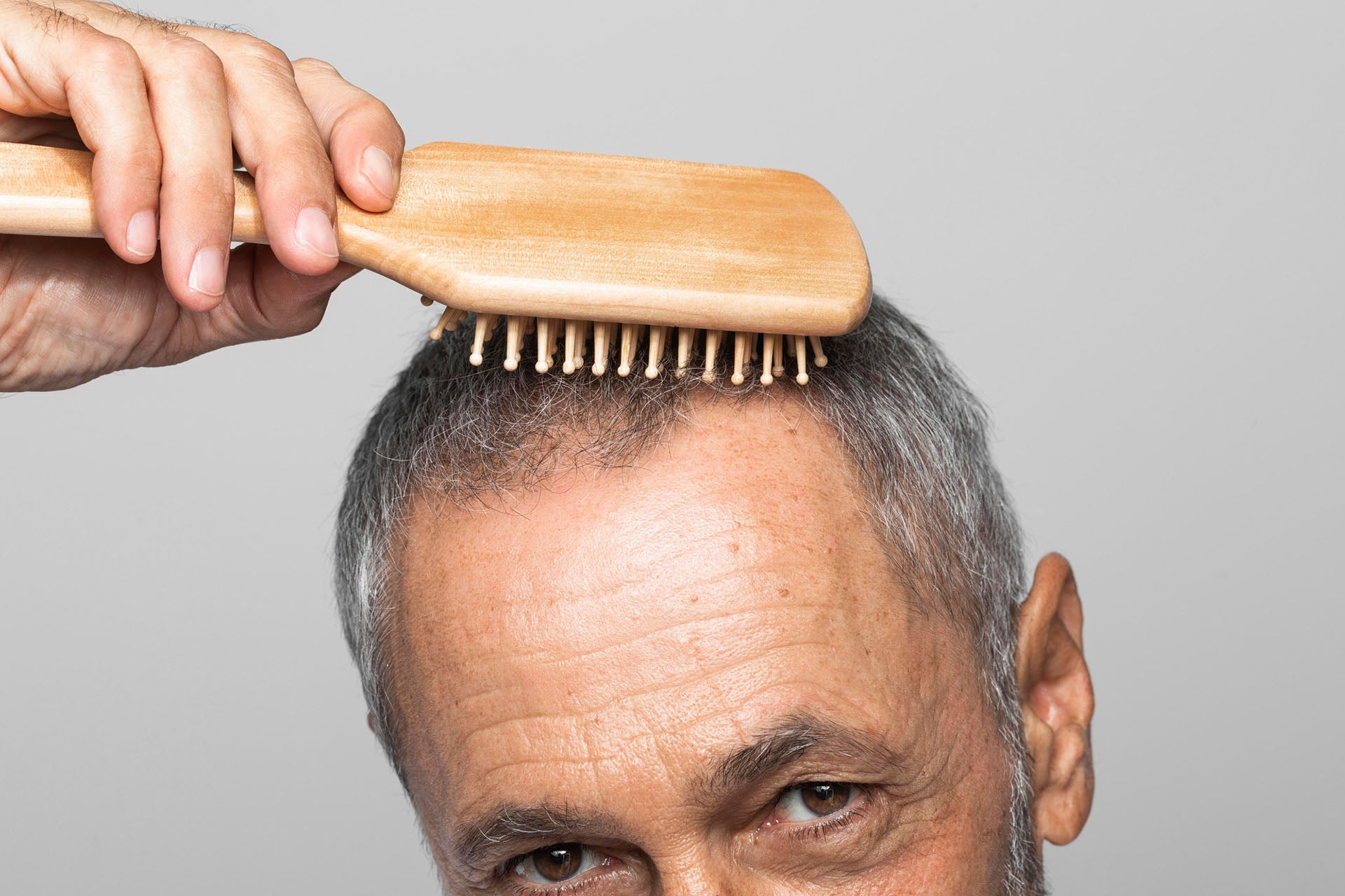 Hairs of Time: Unravelling the Mystery of Ageing and Hair Changes ...
